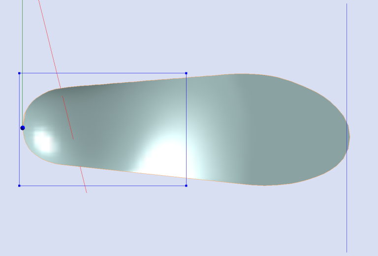 Intrinsic Heel Lift – Orthotics By Design