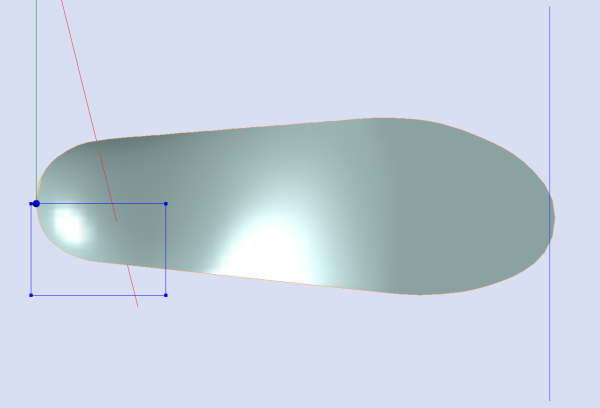 Medial and Lateral Rear Foot Posting (RF Posting) – Orthotics By Design